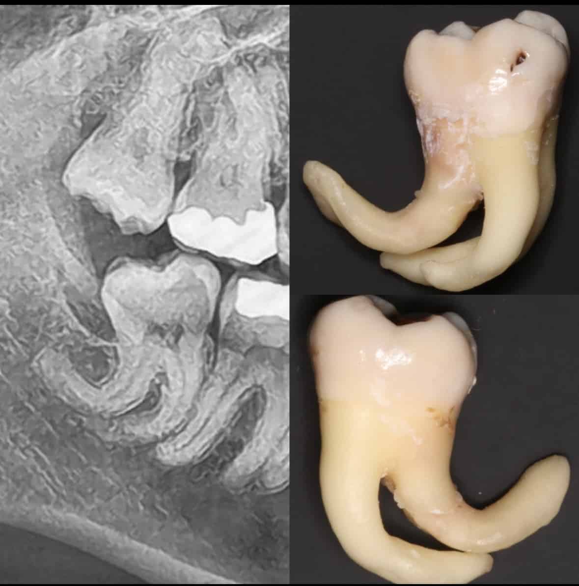 Crazy roots... - Sharrow Vale Dental Care