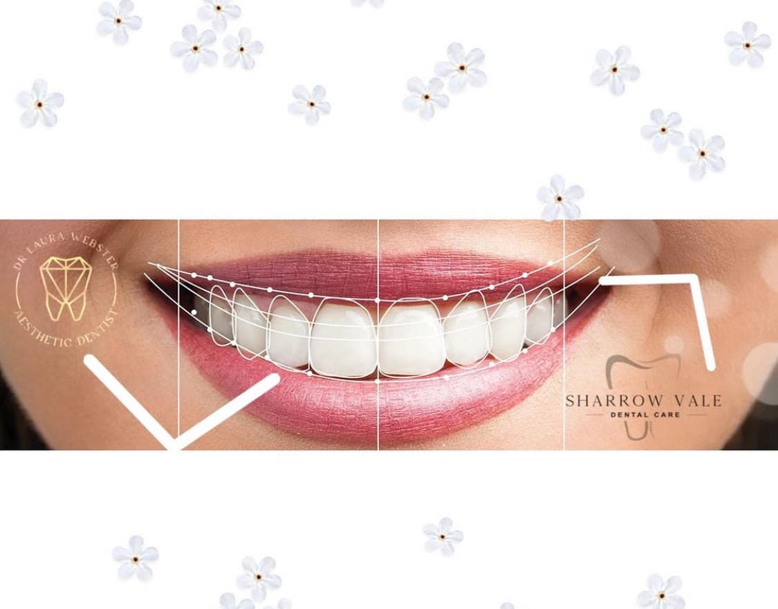 Invisalign & Composite Bonding Open Day - Sharrow Vale Dental Care