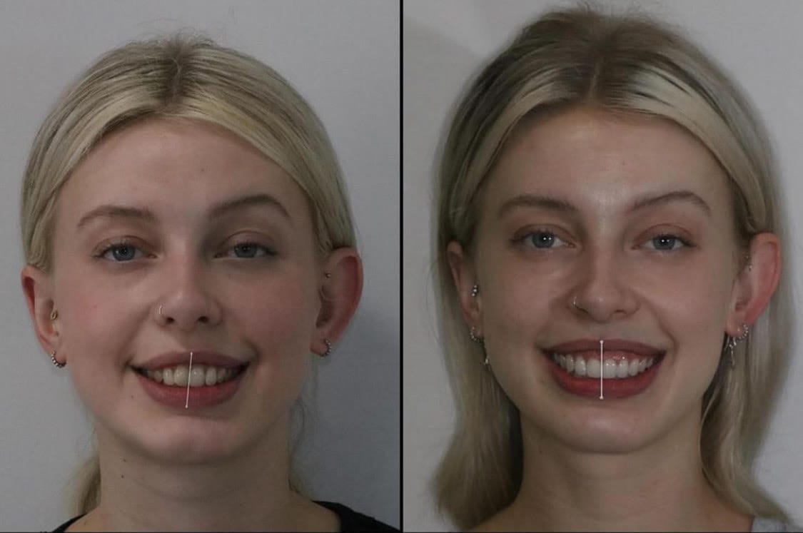 What Makes A Beautiful Smile? - FLOW - Sharrow Vale Dental Care