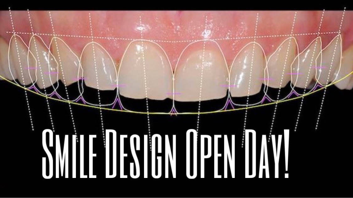 Smile Design Month - Dhivya Mathew - Sharrow Vale Dental Care