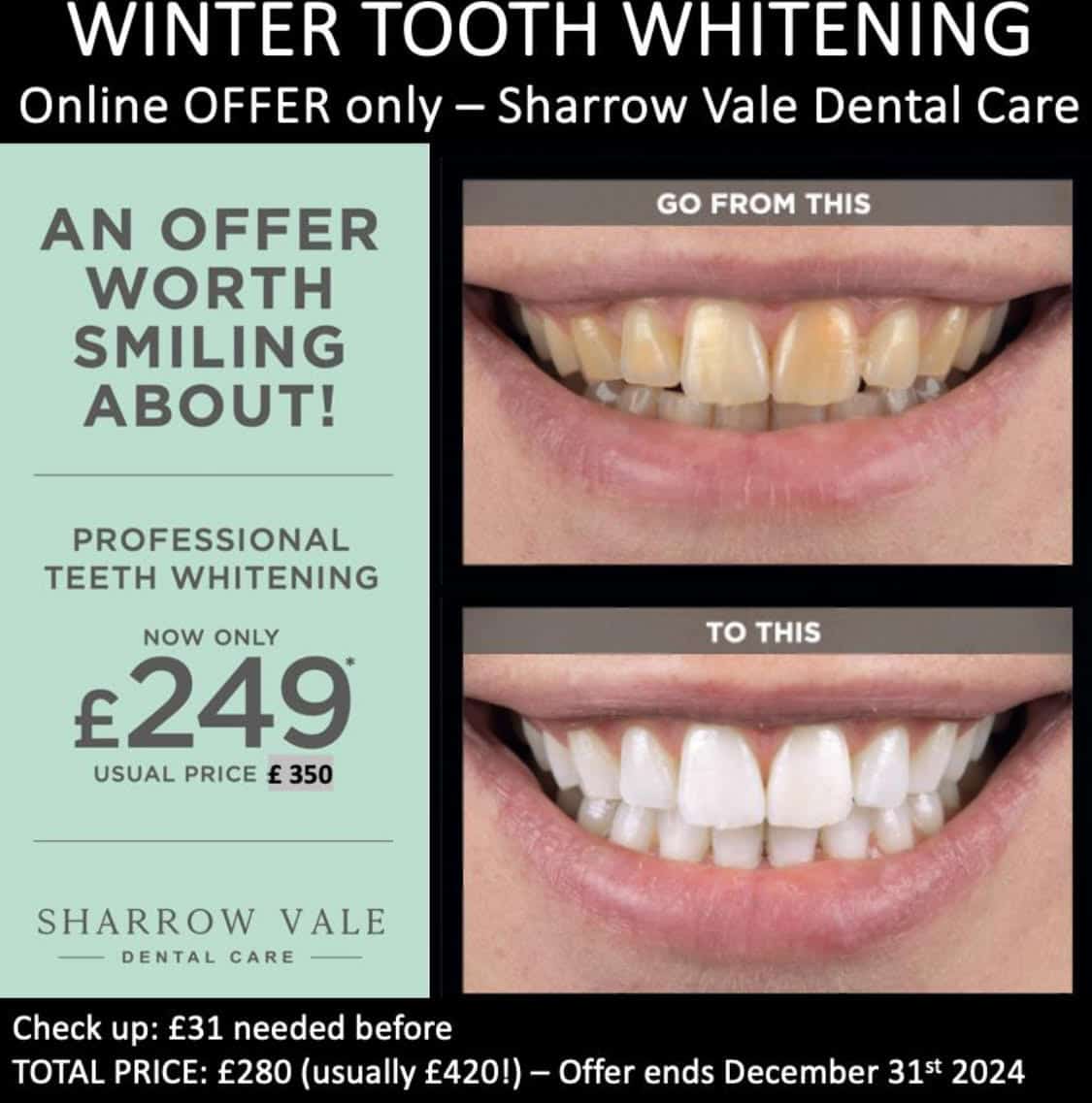 Whitening Offer - Sharrow Vale Dental Care
