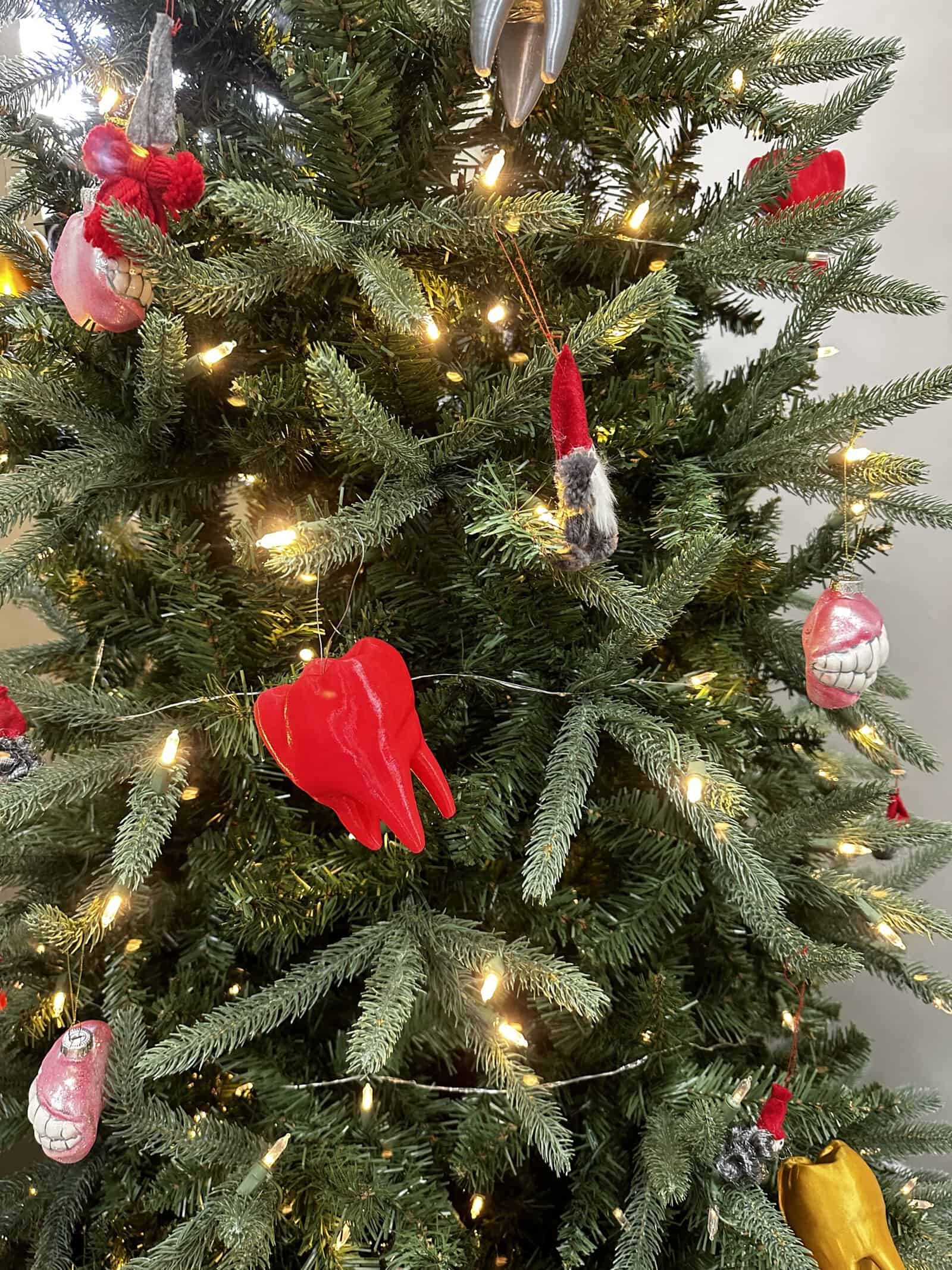 The red teeth are commissioned - Sharrow Vale Dental Care