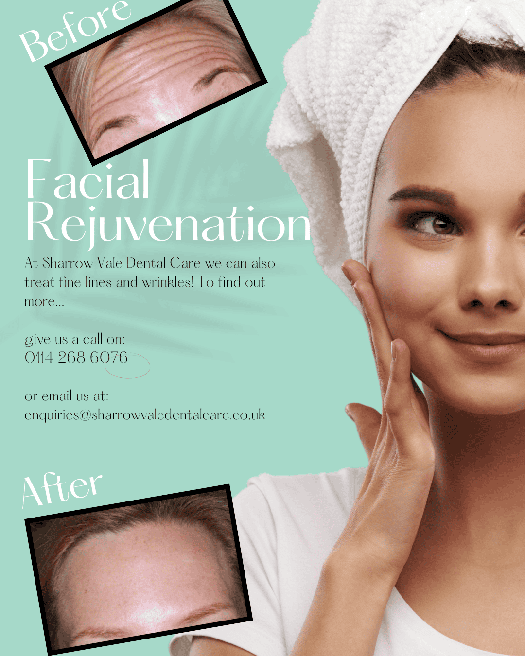Facial Rejuvenation - Sharrow Vale Dental Care