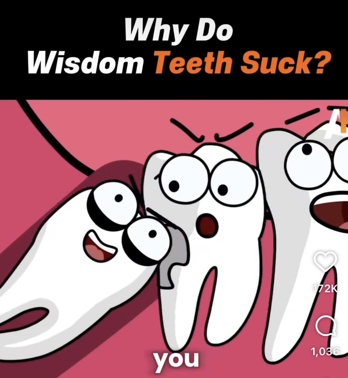 Wisdom teeth - Sharrow Vale Dental Care