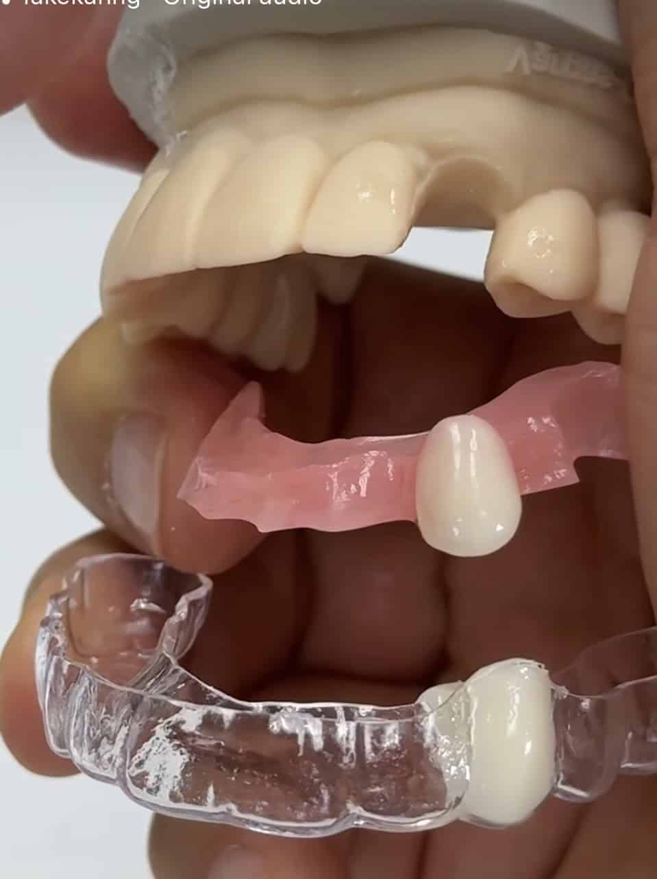Temporary options... - Sharrow Vale Dental Care