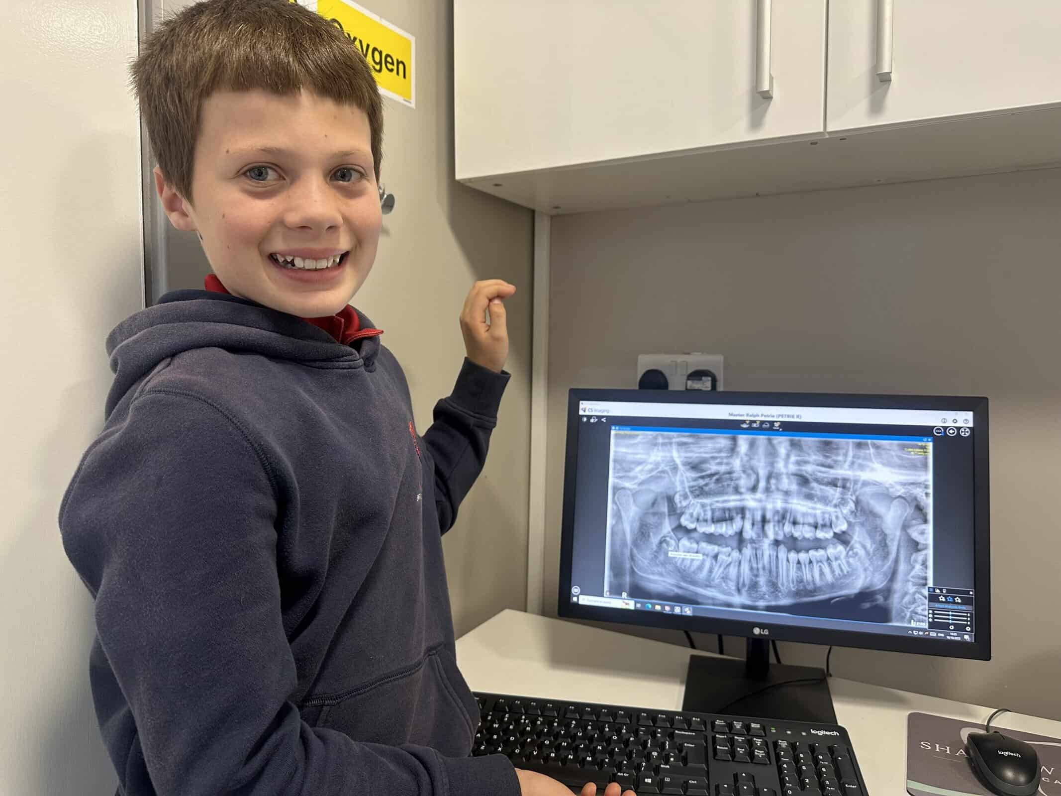 X-rays - Sharrow Vale Dental Care